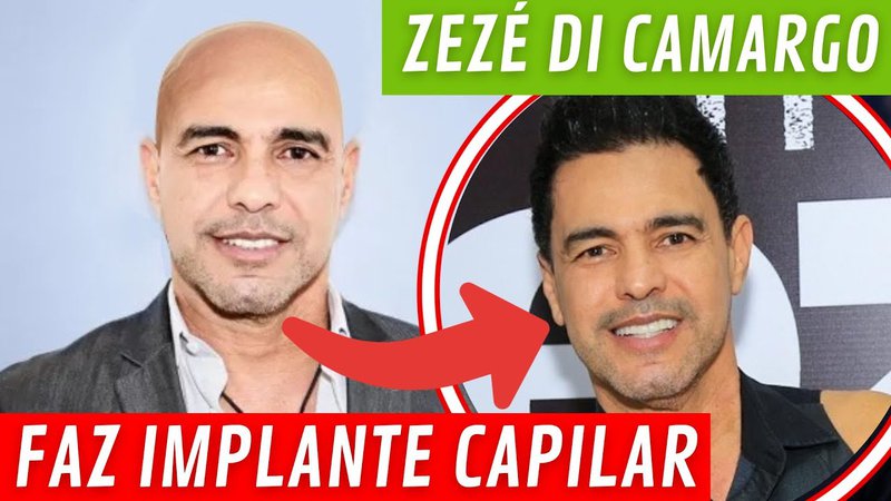 Zezé Di Camargo raspa o cabelo para fazer implante capilar e foge da web - 180graus - O Maior ...