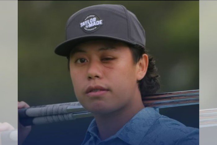 Jovem promessa do golfe perde visão de um olho após bolada em torneio ...