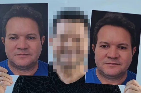 Ximbinha faz harmonização e muda visual novamente - 180graus - O Maior ...