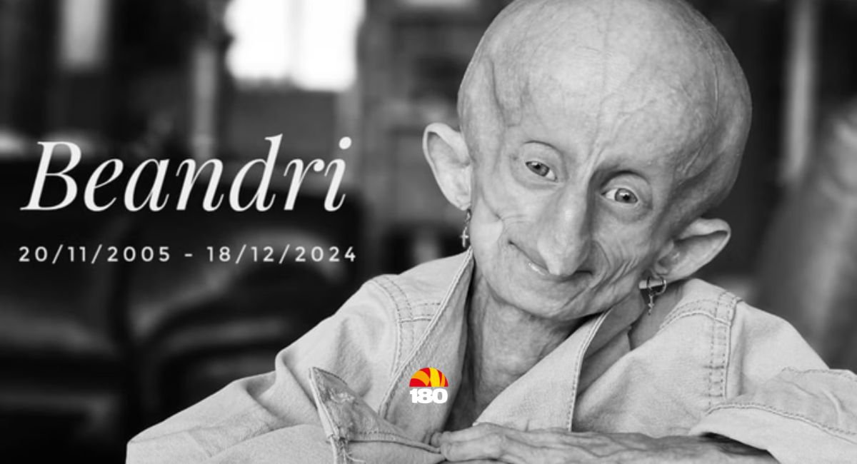 Morre Beandri Booysen, influencer com doença rara, aos 19 anos ...