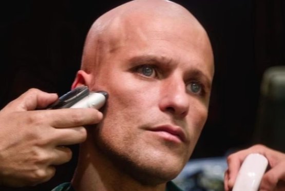 Careca, pálido e 14 kg mais magro: visual de Bruno Gagliasso choca web ...