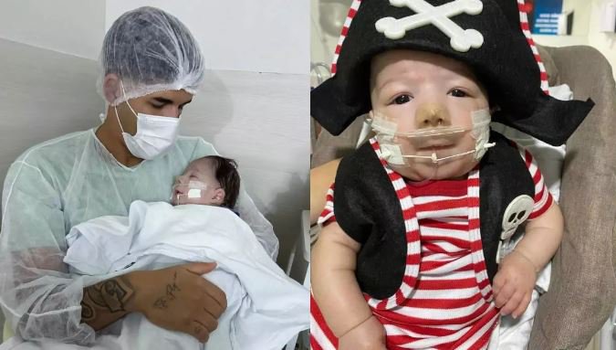 Síndrome de Patau: saiba o que é a condição do bebê Arthur, filho de Zé ...