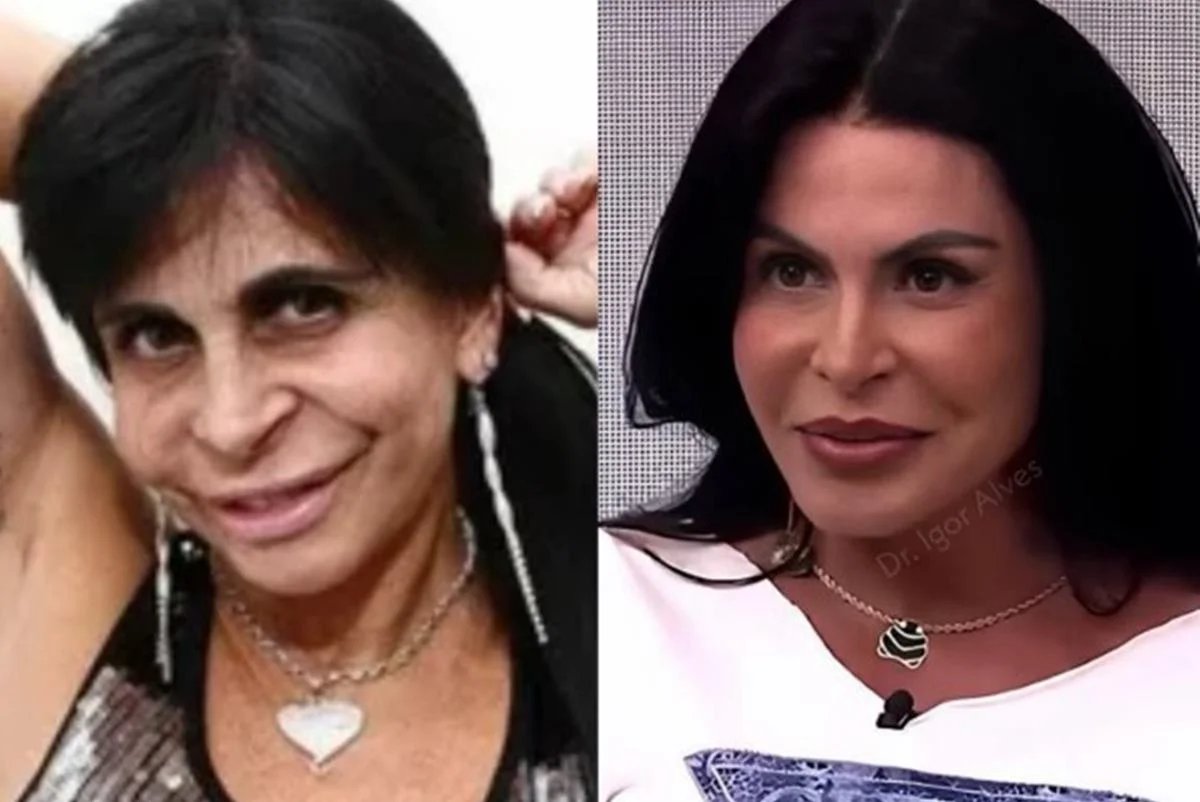 Gretchen surpreende fãs com novo rosto nas redes sociais; confira a ...
