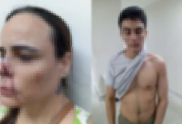 Moradora leva surra de vizinho por causa de latido de cães: “Me socou ...